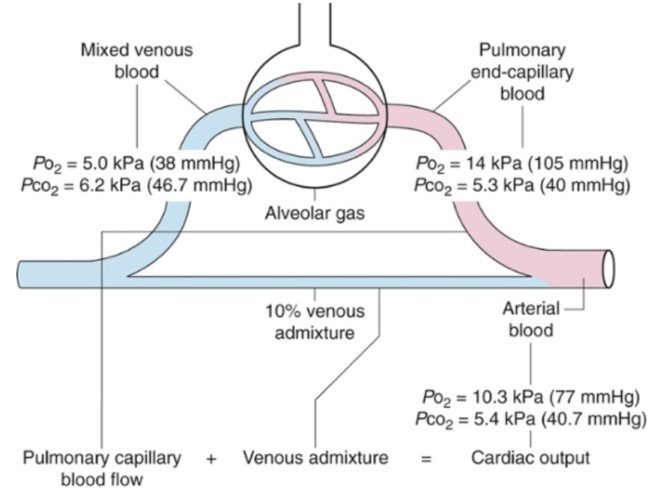 UTI-Club #2: insuficiencia respiratoria hipoxémica – INTERCONSULTA ON-LINE